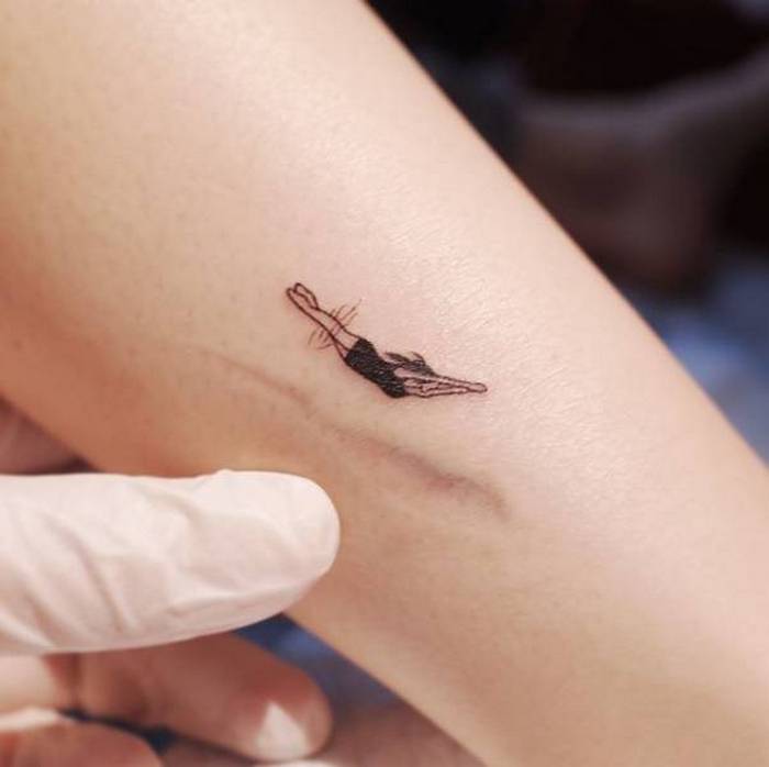 แผลเป็น ซ่อนเร้นได้ ด้วยศิลปะการสัก หรือที่เรียกว่า tattoos ...