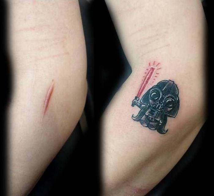 แผลเป็น ซ่อนเร้นได้ ด้วยศิลปะการสัก หรือที่เรียกว่า tattoos ...